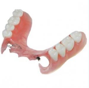 Partial Dentures – The Denture Center